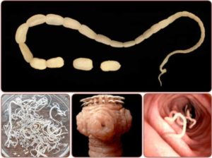 Pumpkin seeds to get rid of worms, parasites, and tapeworms